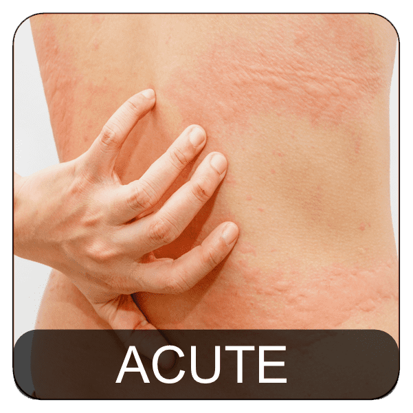 Differential Diagnosis of Common Dermatologic Disorders | Part 1: Acute