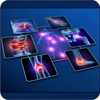 Differential Diagnosis of Common Musculoskeletal Disorders Part 2 ...