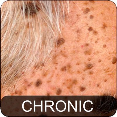 Differential Diagnosis of Common Dermatologic Disorders | Part 2 ...