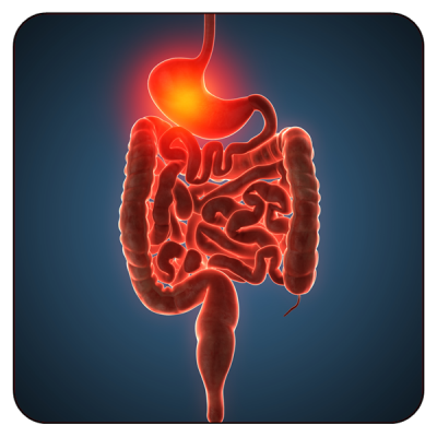 Differential Diagnosis of Common Gastrointestinal Disorders - Part 2