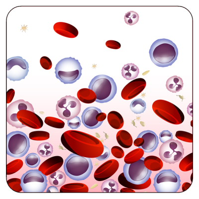 Differential Diagnosis of Common Hematologic Disorders Part 2 Leukemia ...